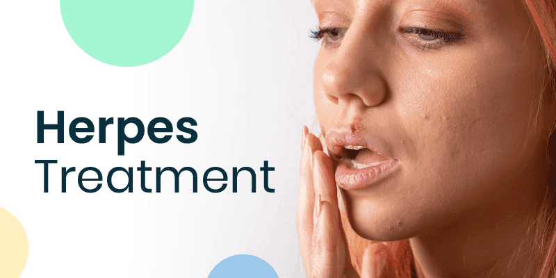 Effective Herpes Treatments: Managing Outbreaks and Symptoms